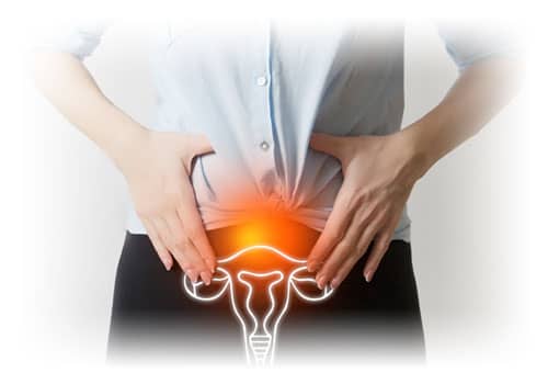 Was ist eine Eileiterentzündung? | McApotheke.com